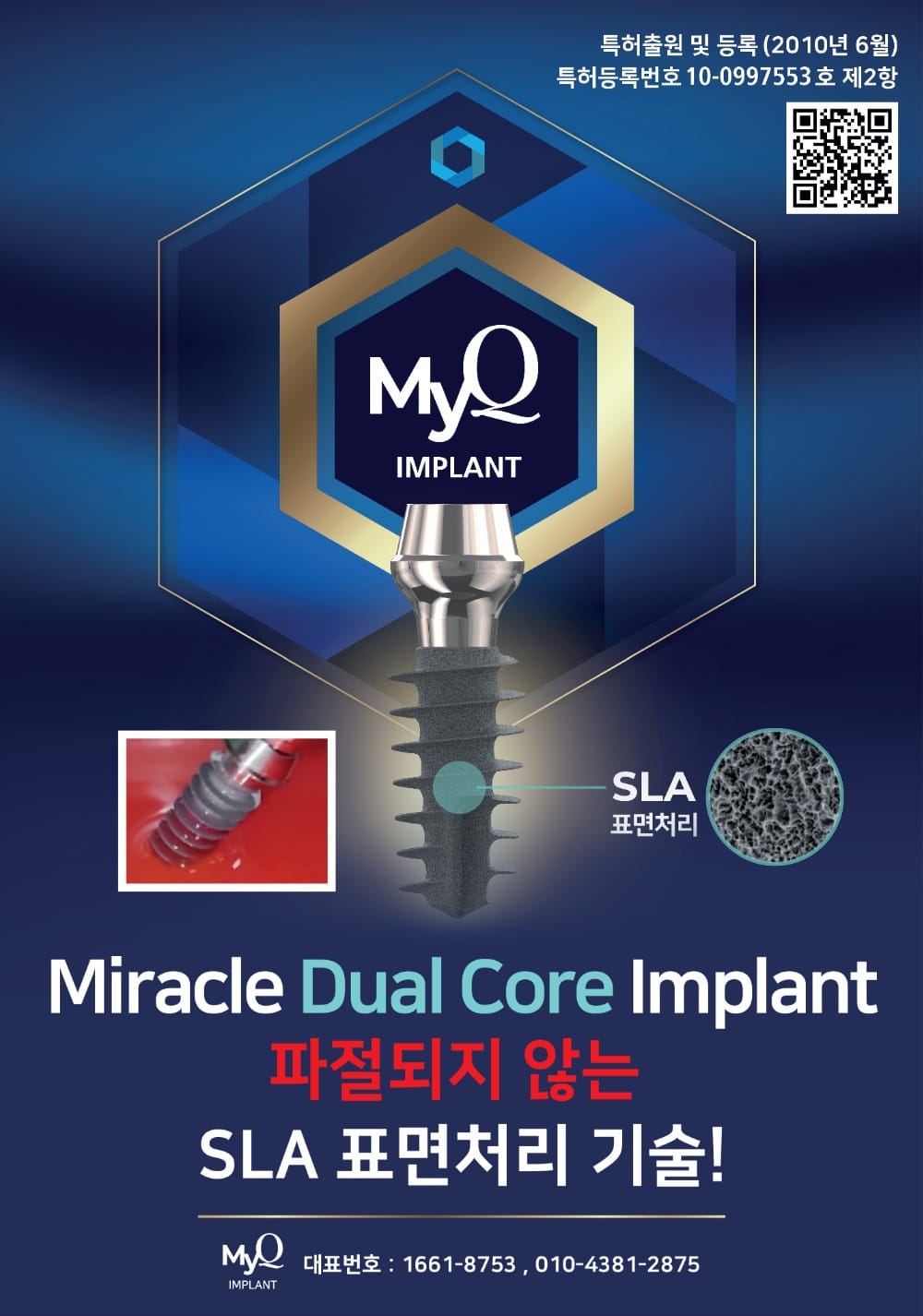 Implant My-Q Tissue Level