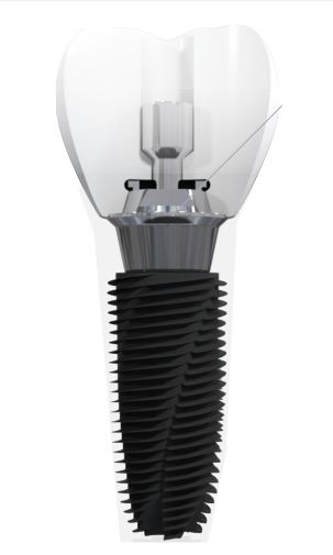 Ưu điểm của dòng Implant Yes Biotech: